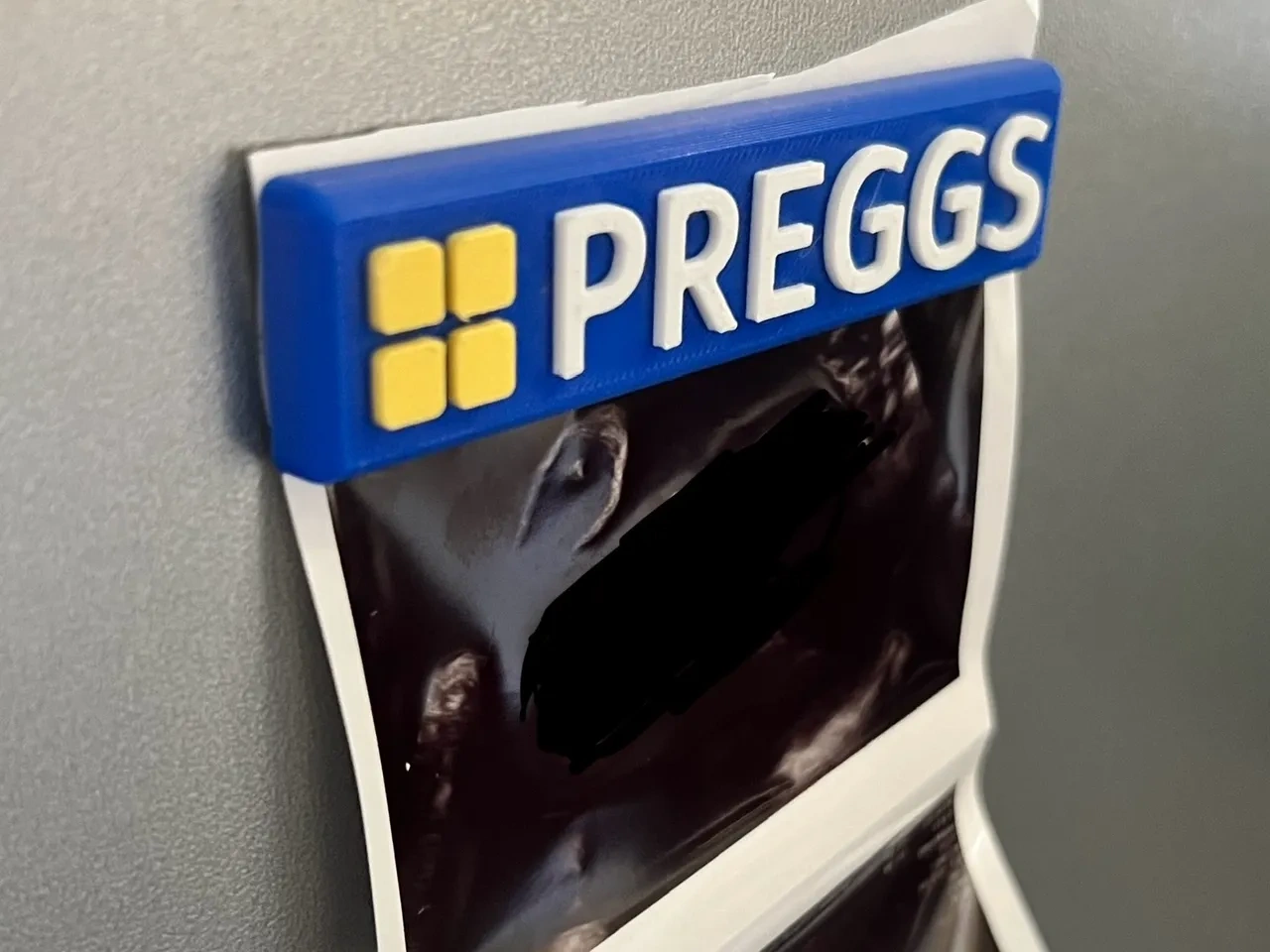 PREGGS - 宝宝扫描照片冰箱磁铁（6x2mm） 来自 Trinkify3D - MakerWorld