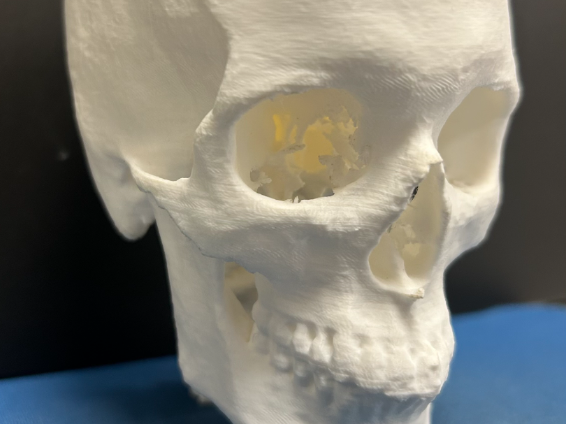 我自己的CT扫描生成的头骨 来自 tonpimenta MakerWorld：免费下载 3D 模型