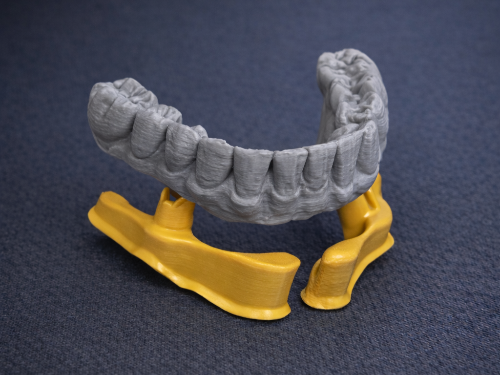 下颌 Ibar 多伦多桥 - 免费 3D 打印模型 - MakerWorld